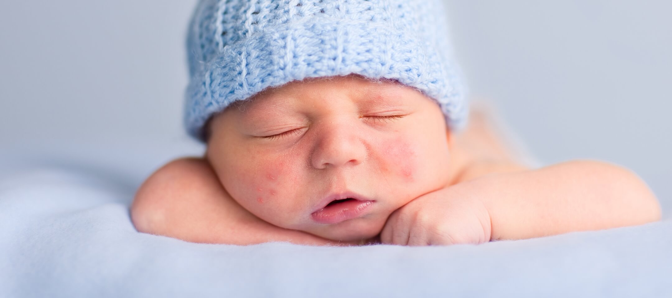 İsilik Nedir? İsilik Neden Olur ve Nasıl Geçer?